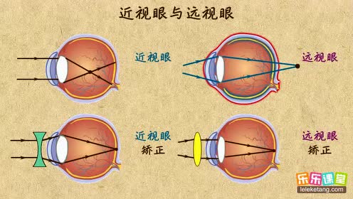 近视远视老花眼 腾讯视频全网搜
