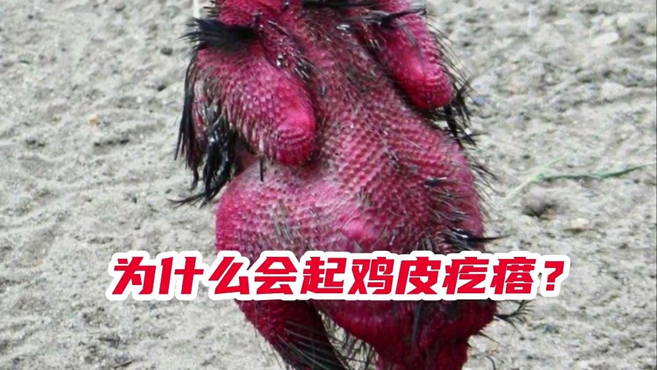 鸡皮疙瘩 生理学名词 搜狗百科