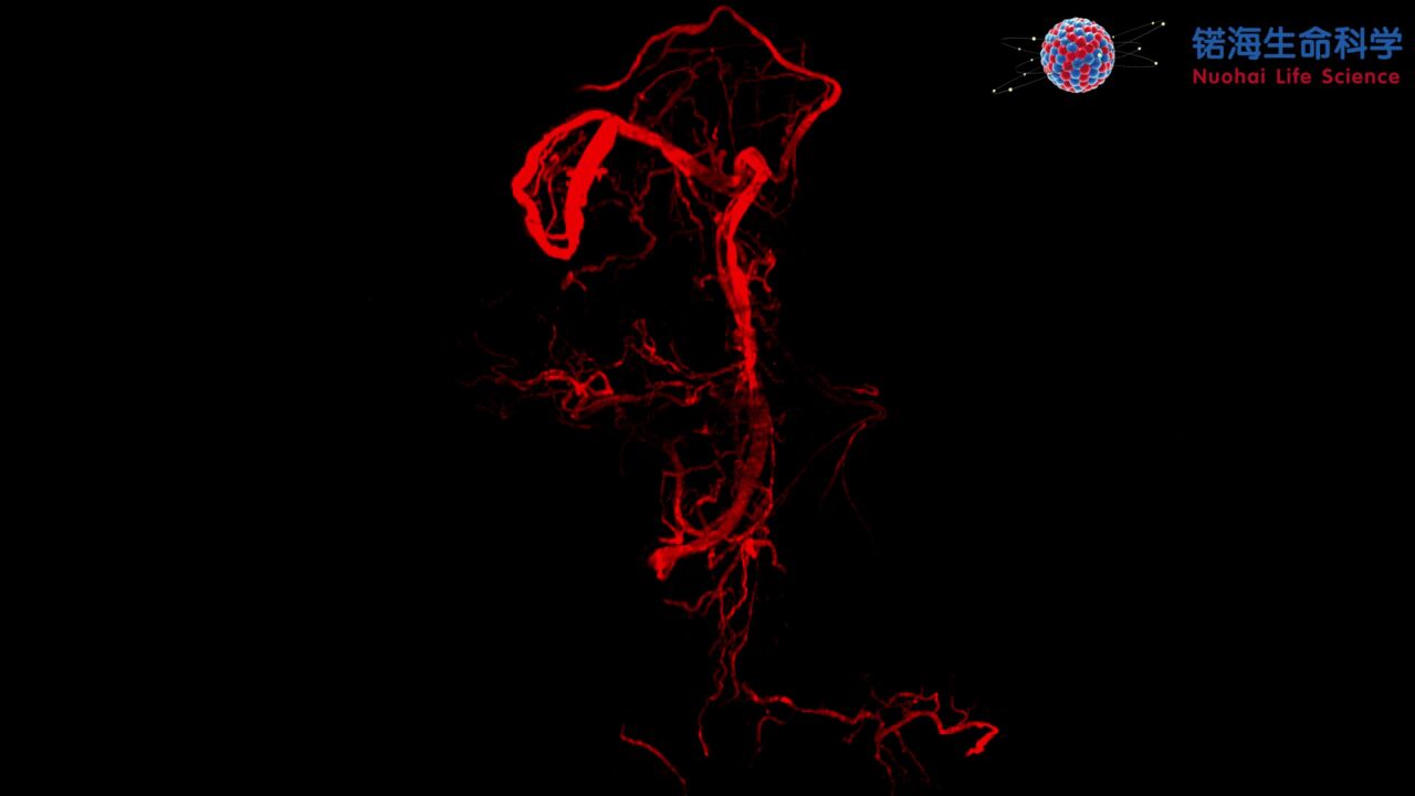 小鼠附睾脂肪SM22染色标记大血管_腾讯视频