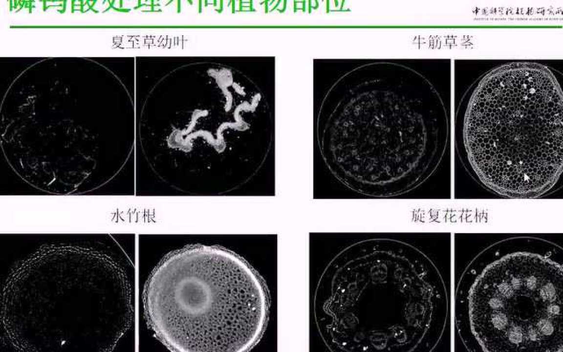 徐秀苹 中国科学院植物研究所 显微ct技术在植物研究中的应用 腾讯视频