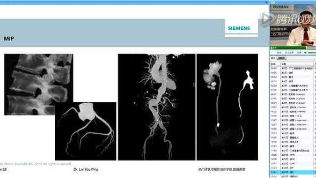 CT三维重建的方法和临床价值_腾讯视频