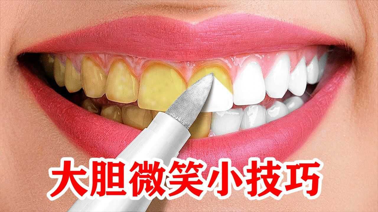大黄牙如何才能变得洁白？几个小妙招教给你，笑得比郭碧婷还美！#知识π计划-知识抢先知#_高清1080P在线观看平台_腾讯视频