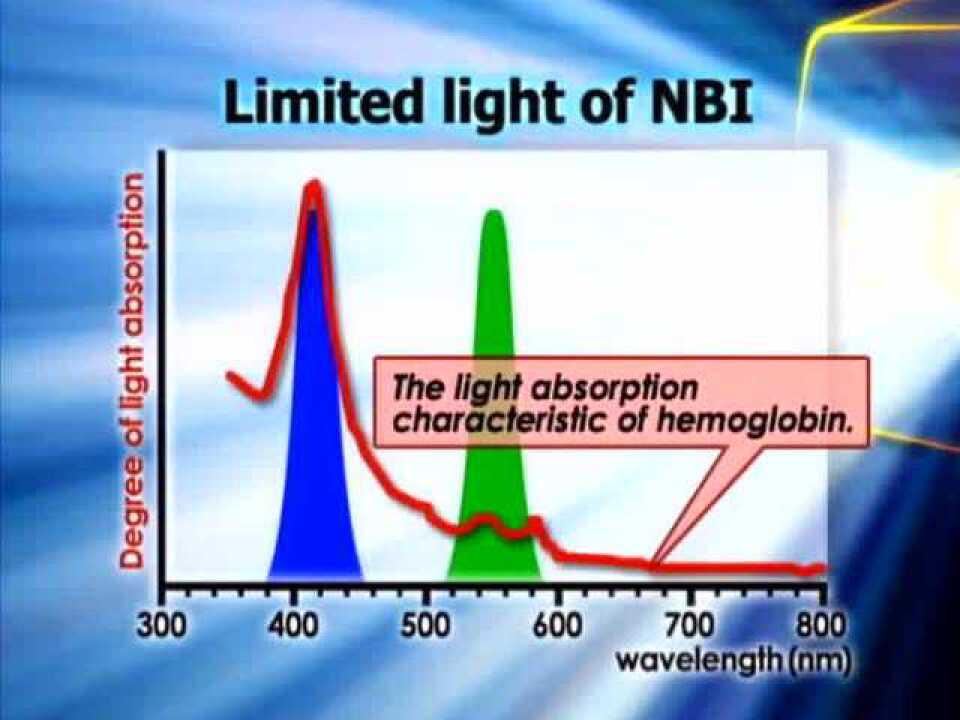 NBI（窄带成像）原理介绍_腾讯视频