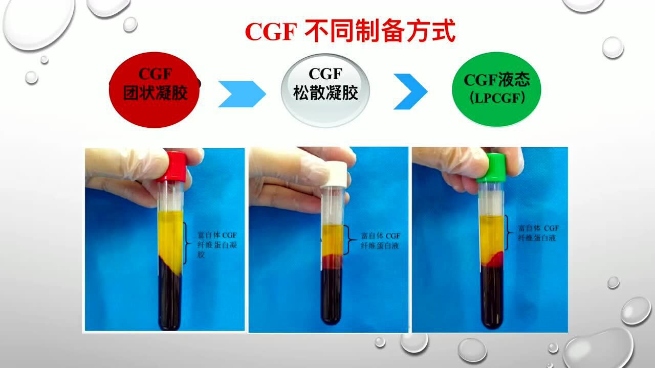 CGF自体活性因子的应用_高清1080P在线观看平台_腾讯视频