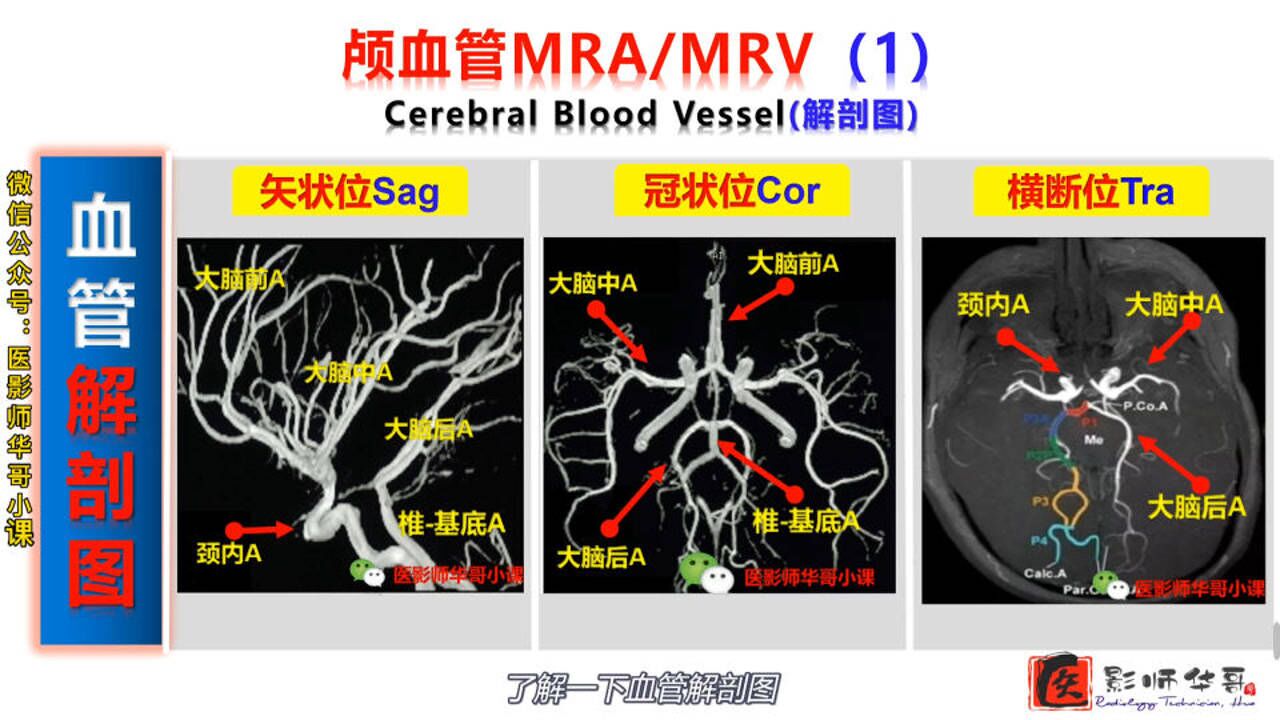MRI扫描定位1脑血管MRA与MRV---磁共振MRI扫描定位线_高清1080P在线观看平台_腾讯视频