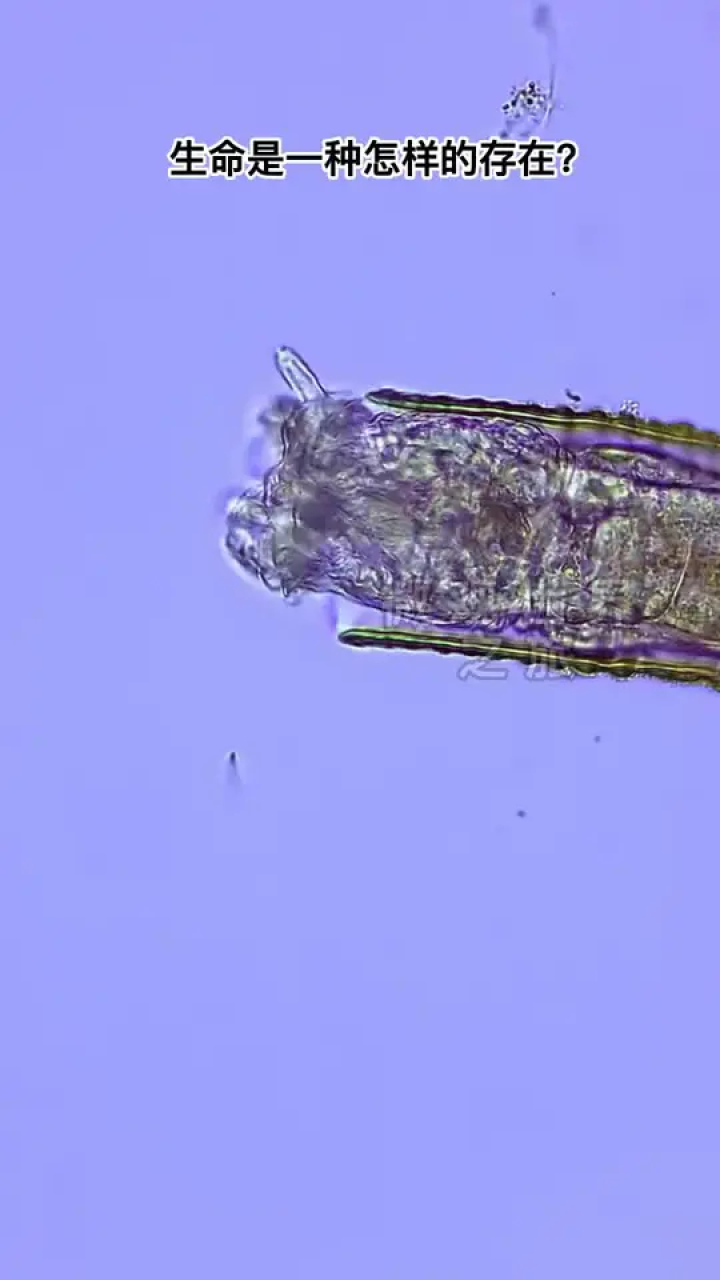 奇特的生命#轮虫#微生物#显微镜#趣味科普_高清1080P在线观看平台_腾讯视频