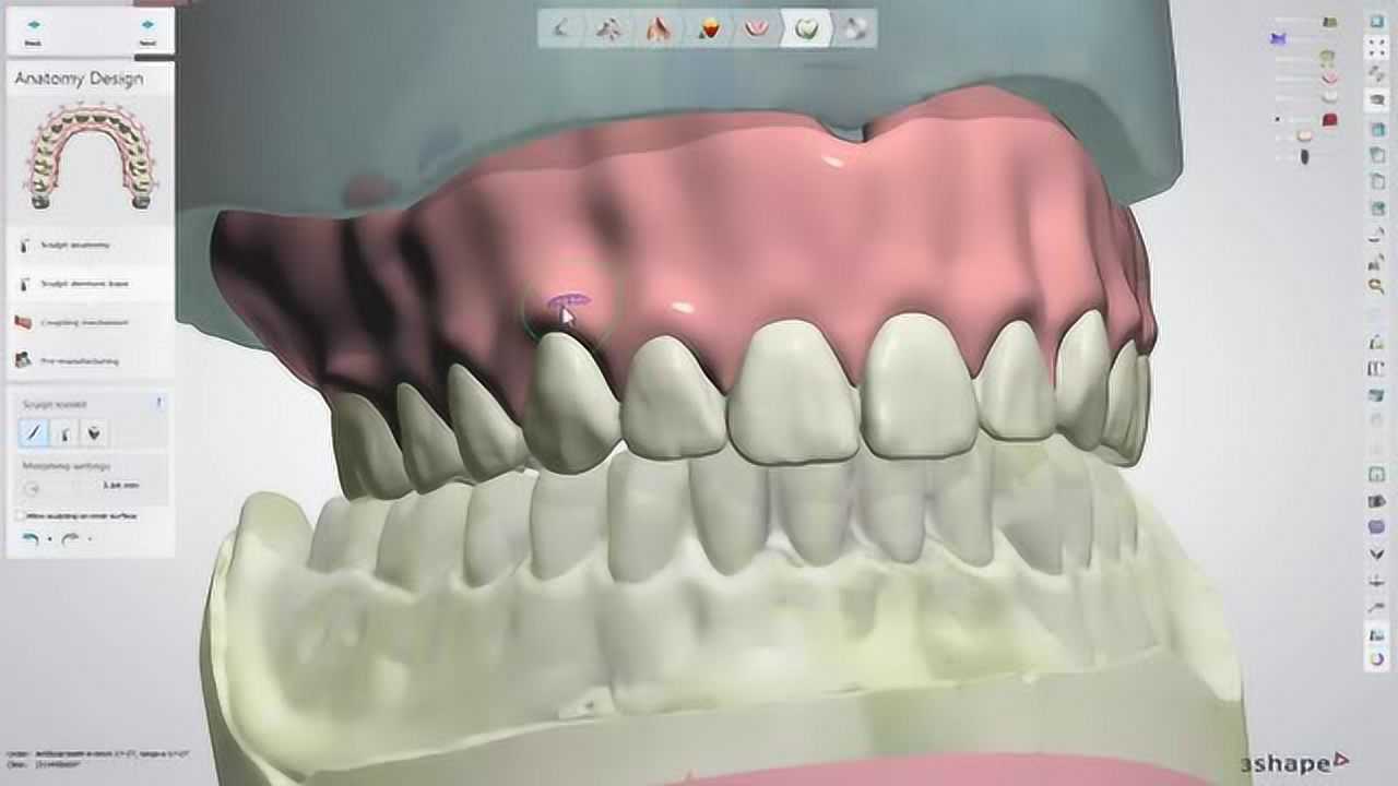3Shape DS 全口义齿设计_腾讯视频