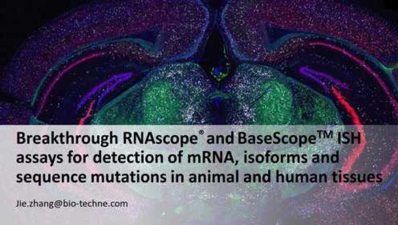单细胞单分子RNA原位杂交技术——RNAscope_高清1080P在线观看平台_腾讯视频