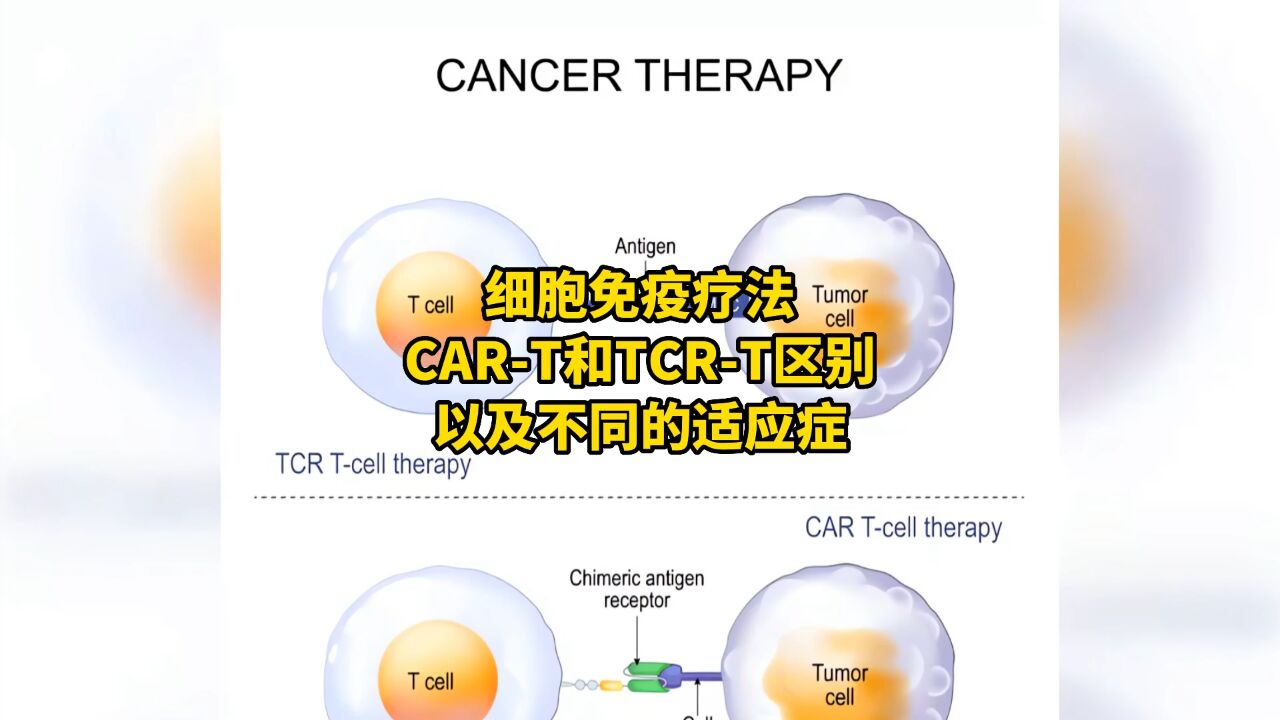 细胞免疫疗法CAR-T和TCR-T的区别，以及不同的适应症_高清1080P在线观看平台_腾讯视频