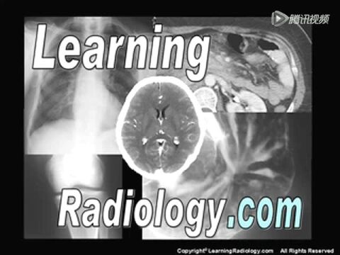 01-The 5 Basic Radiographic Densities_腾讯视频