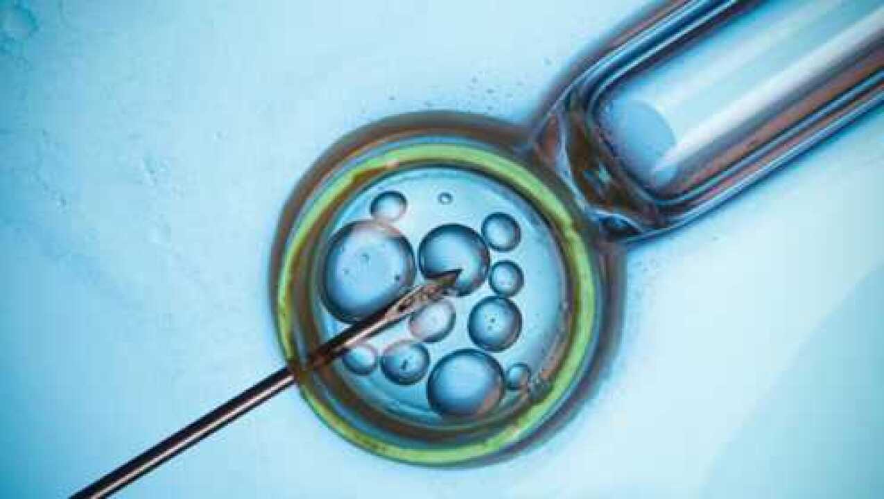 ICSI操作_高清1080P在线观看平台_腾讯视频