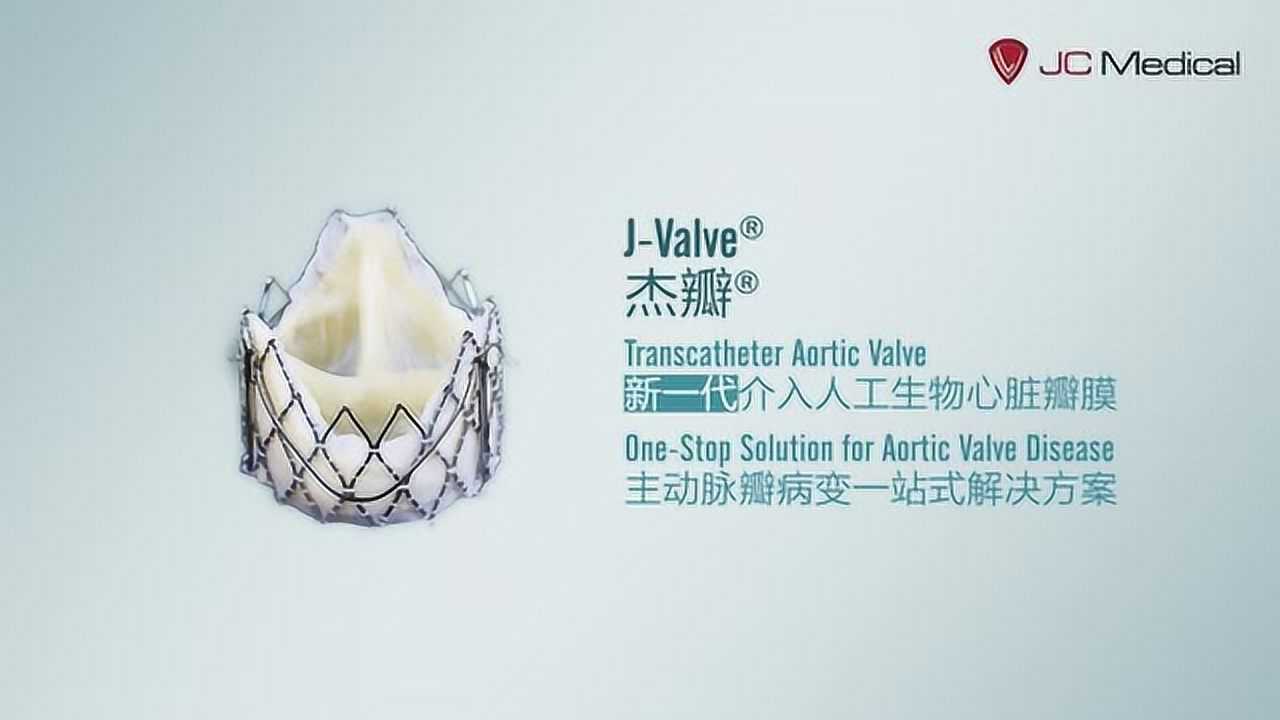 J-Valve(R)杰瓣(R)新一代介入人工生物心脏瓣膜_高清1080P在线观看平台_腾讯视频