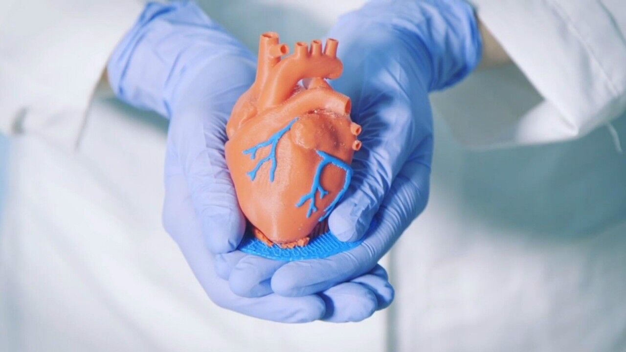 3D打印心脏，像真心脏一样工作，造福千万心脏病患者_高清1080P在线观看平台_腾讯视频
