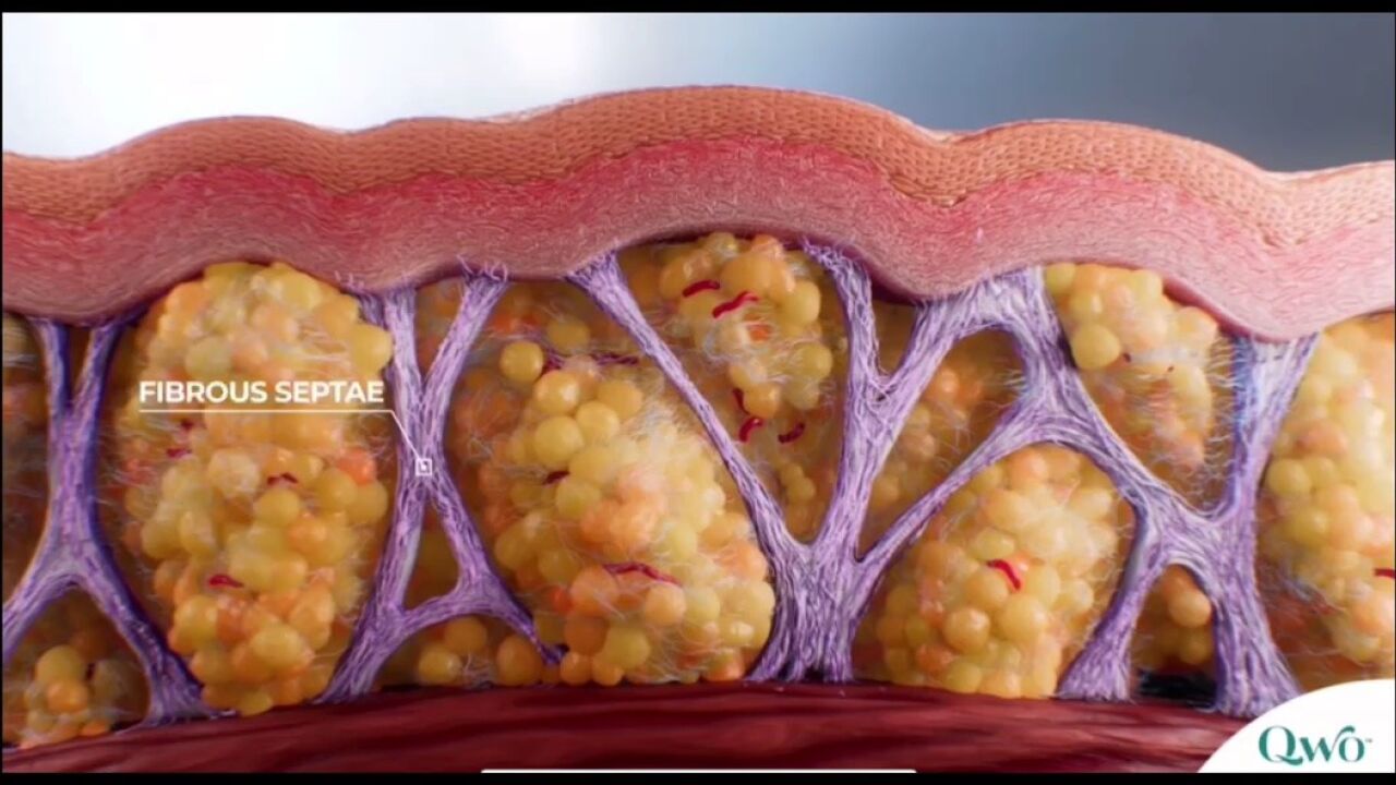 变胖的过程，脂肪细胞变大_腾讯视频