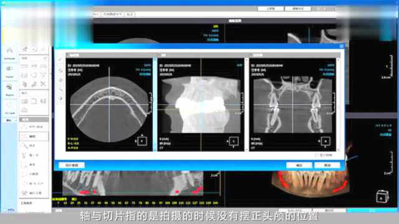 Ondemand3D基本功能_高清1080P在线观看平台_腾讯视频