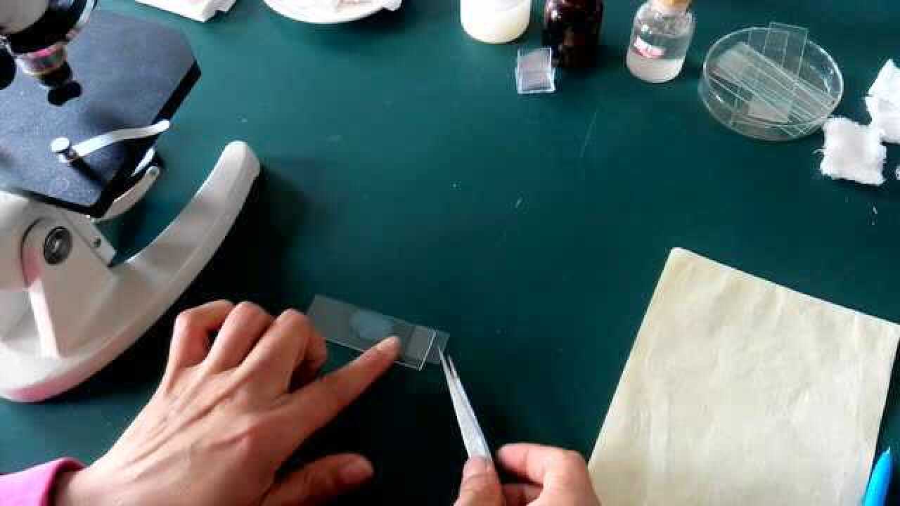 14.显微镜下观察酵母菌的细胞._高清1080P在线观看平台_腾讯视频