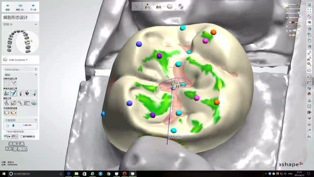 专业的3shape口腔设计_腾讯视频