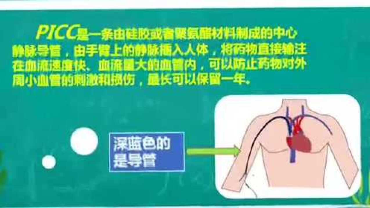 PICC居家护理_高清1080P在线观看平台_腾讯视频