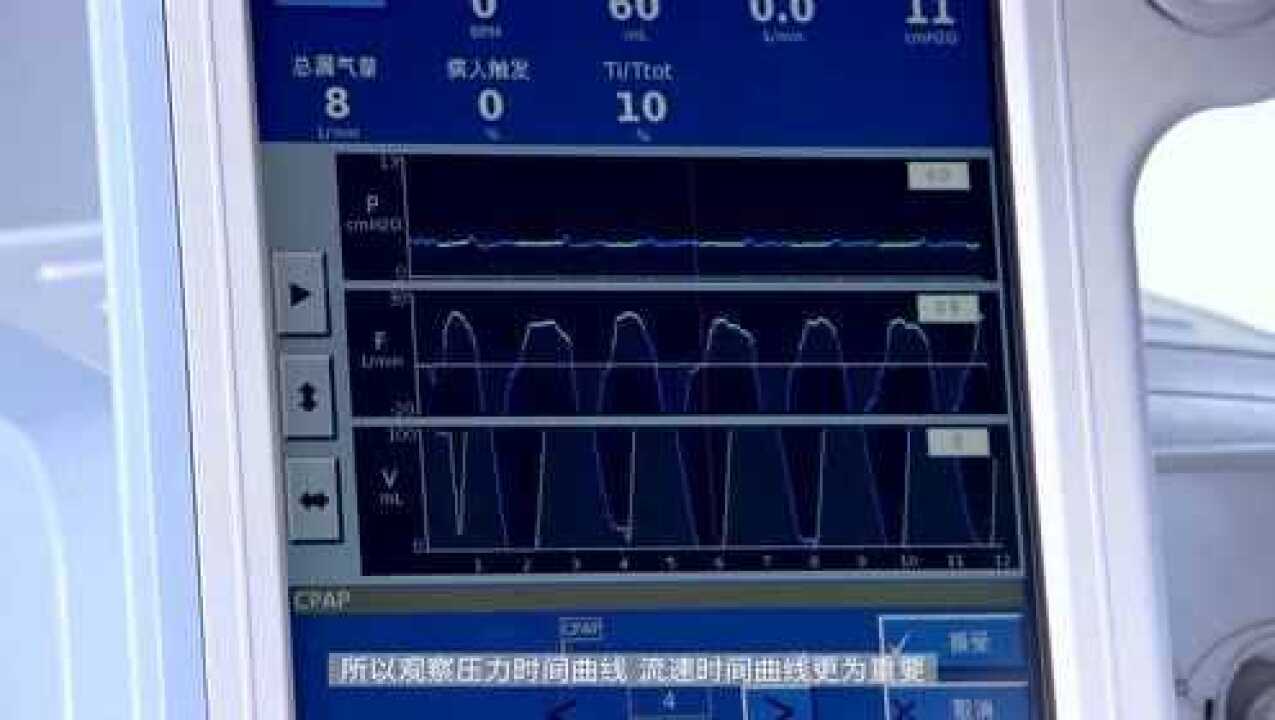 飞利浦V60无创呼吸机模式与参数_高清1080P在线观看平台_腾讯视频
