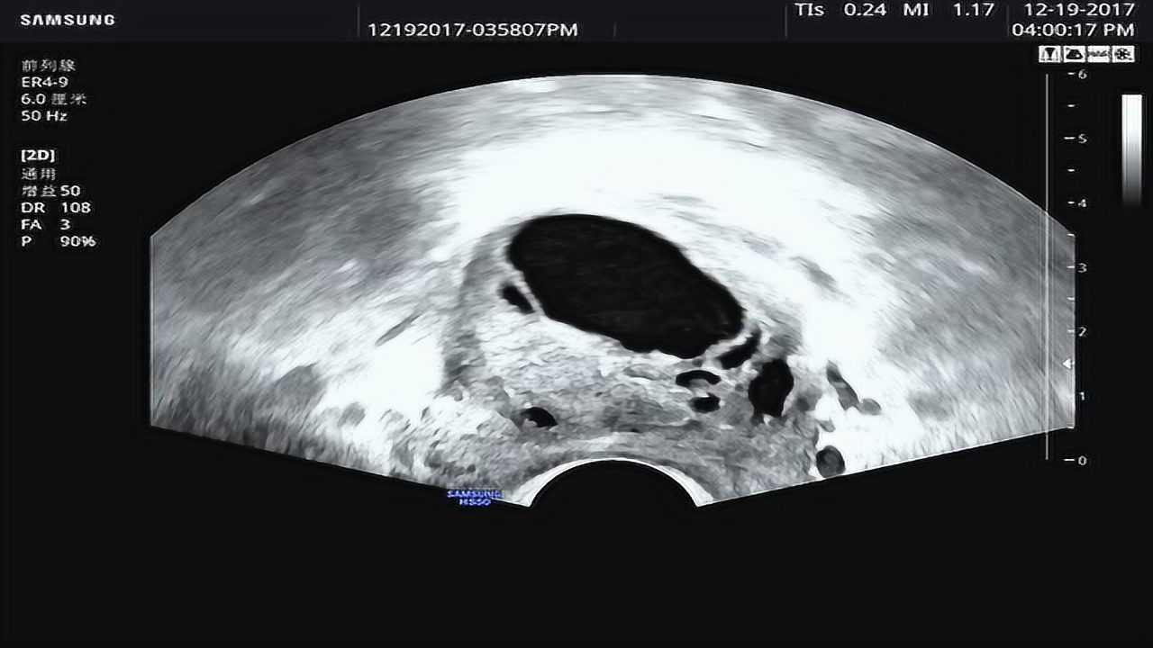 HS50A图片_高清1080P在线观看平台_腾讯视频