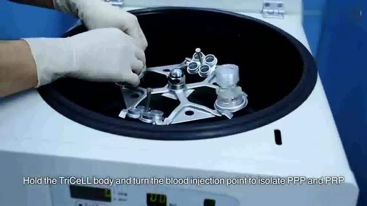 Tricell PRP制备流程_腾讯视频