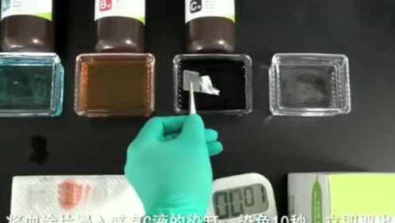 diff-quik动物细胞染色液浸染法