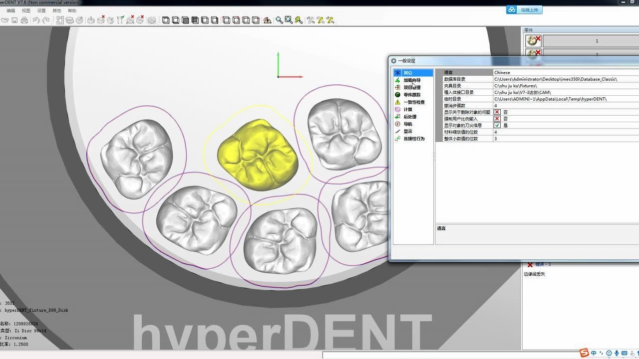hyperDENT-排版_高清1080P在线观看平台_腾讯视频