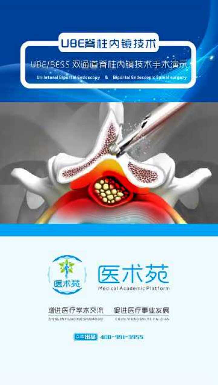 UBE-BESS 双通道脊柱内镜技术手术演示【医术苑】_腾讯视频