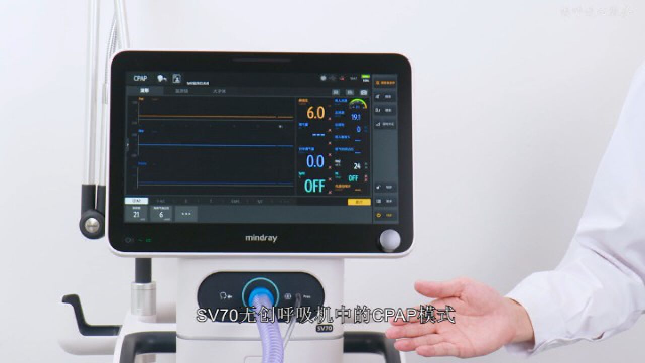 SV70无创呼吸机中的CPAP模式_高清1080P在线观看平台_腾讯视频