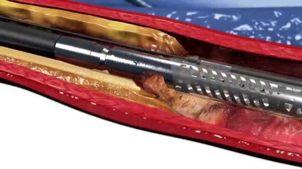 Turbohawk模拟动画_高清1080P在线观看平台_腾讯视频