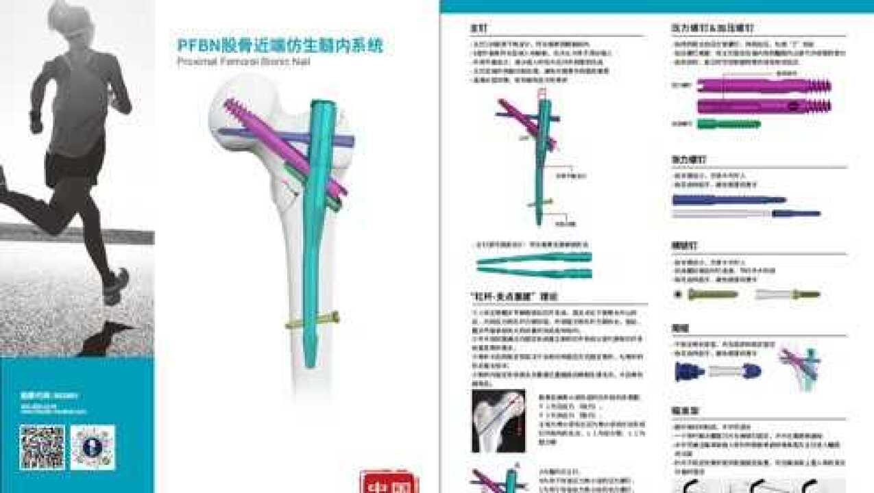 PFBN 仿生髓内钉 - 大博医疗_腾讯视频