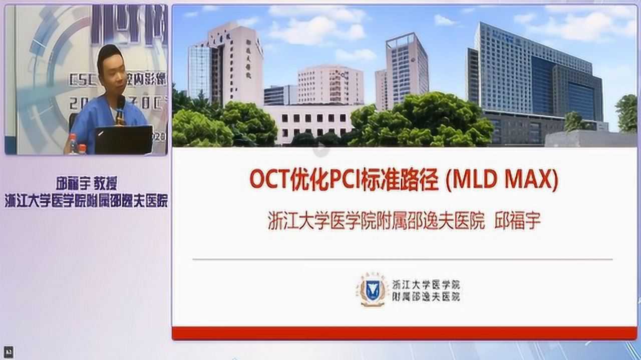 邱福宇-OCT优化PCI标准路径（MLD-MAX)&Lightlab研究解读_高清1080P在线观看平台_腾讯视频