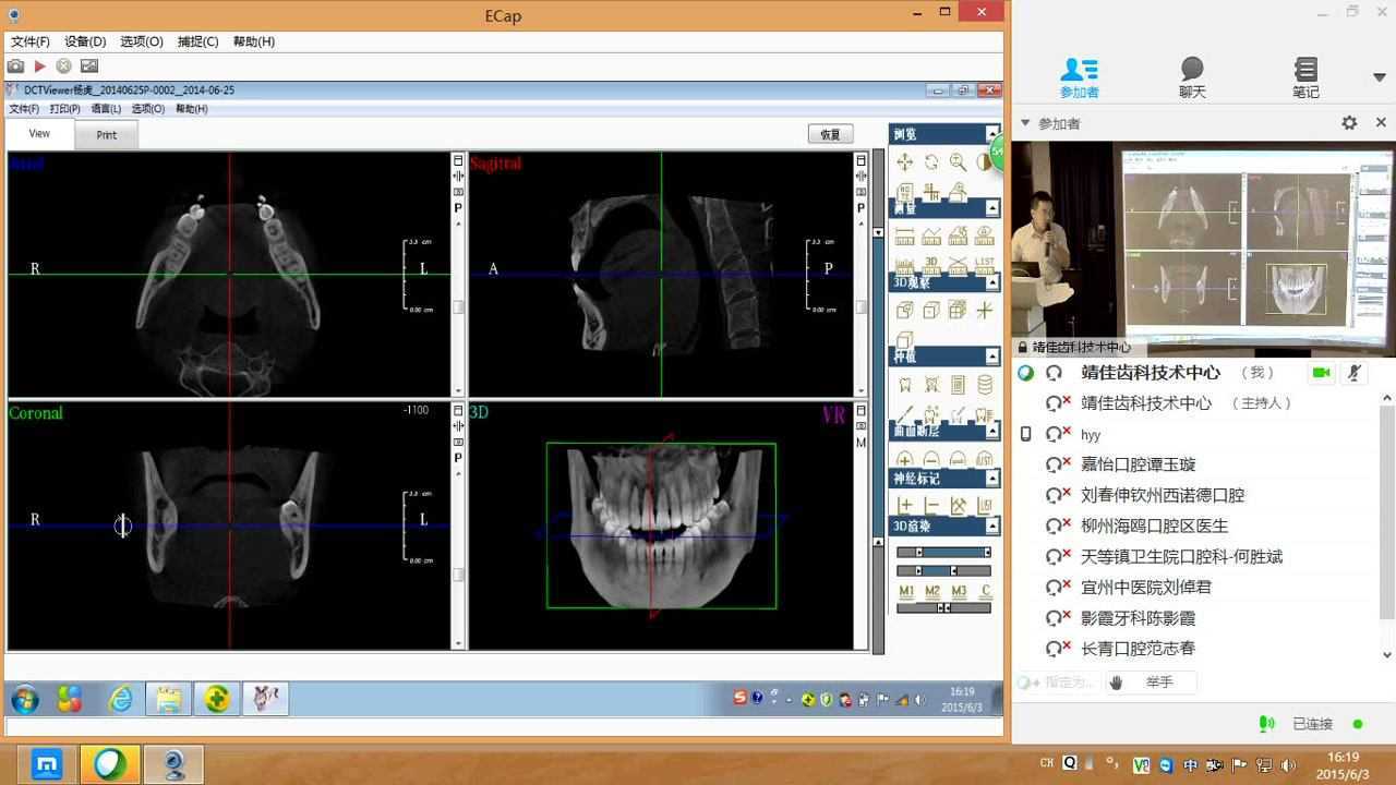 CBCT原理、口腔CT影像学知识及在口腔科中的临床应用范围-4_高清1080P在线观看平台_腾讯视频