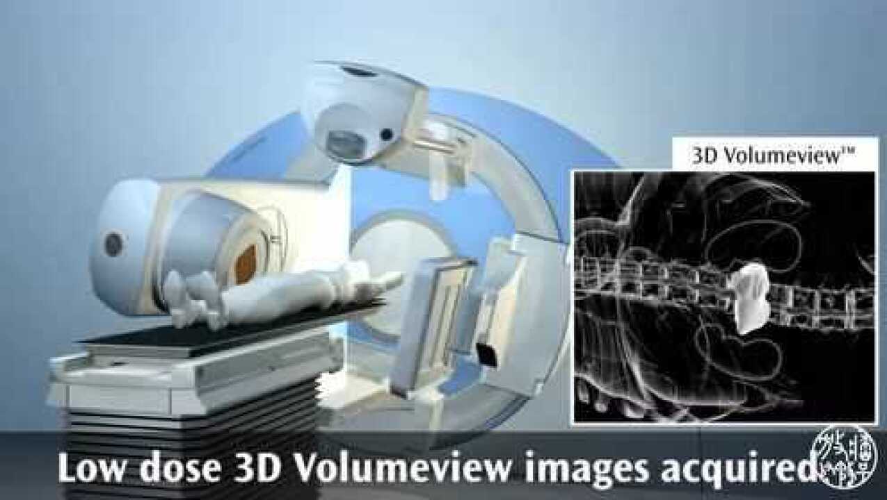 CBCT技术介绍_腾讯视频