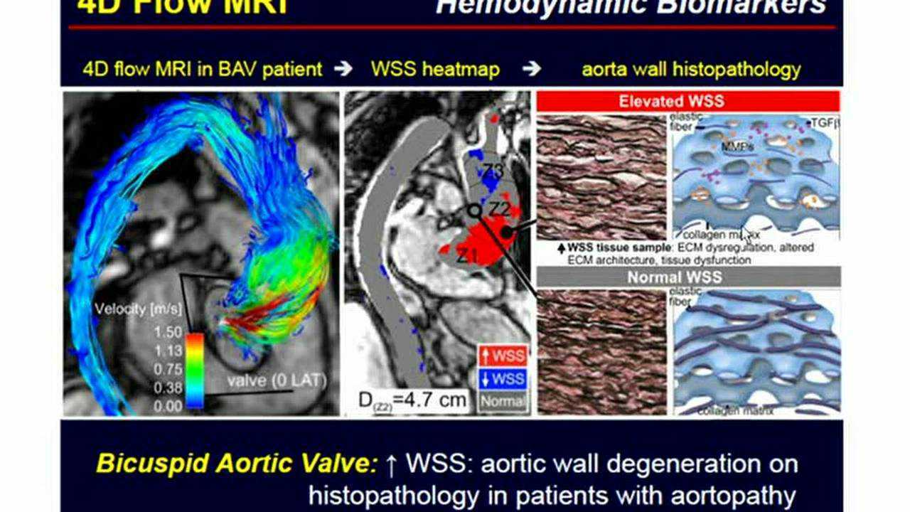 4DflowMR血管成像技术进展_高清1080P在线观看平台_腾讯视频
