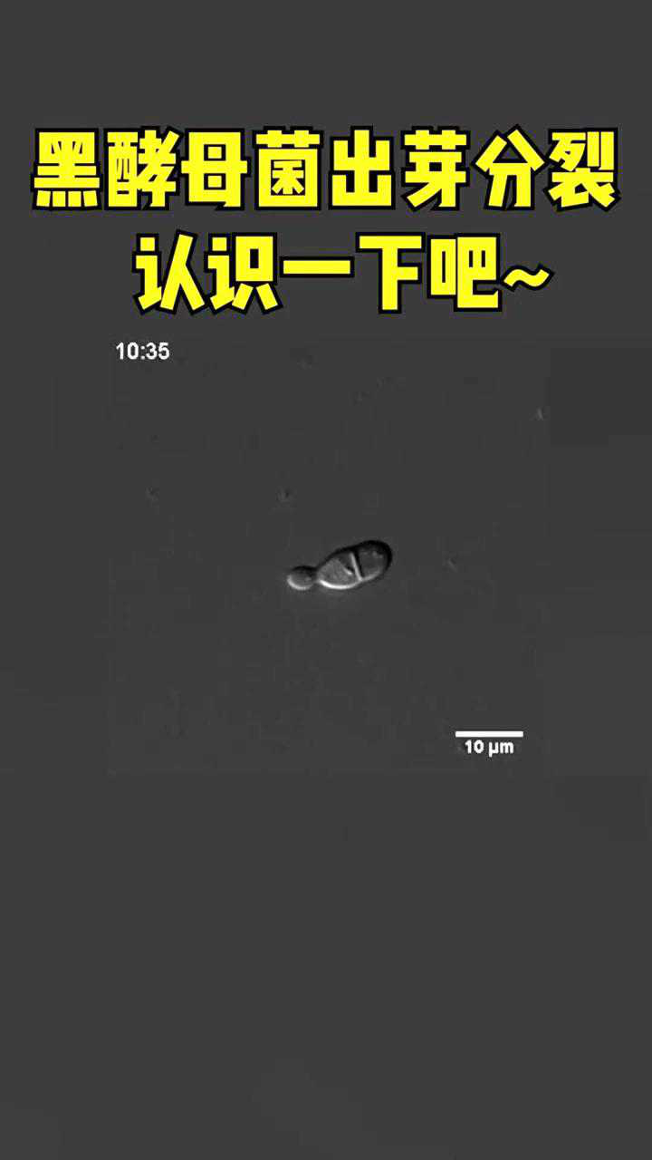 显微镜下的世界，黑酵母菌出芽分裂过程，真是努力！_腾讯视频