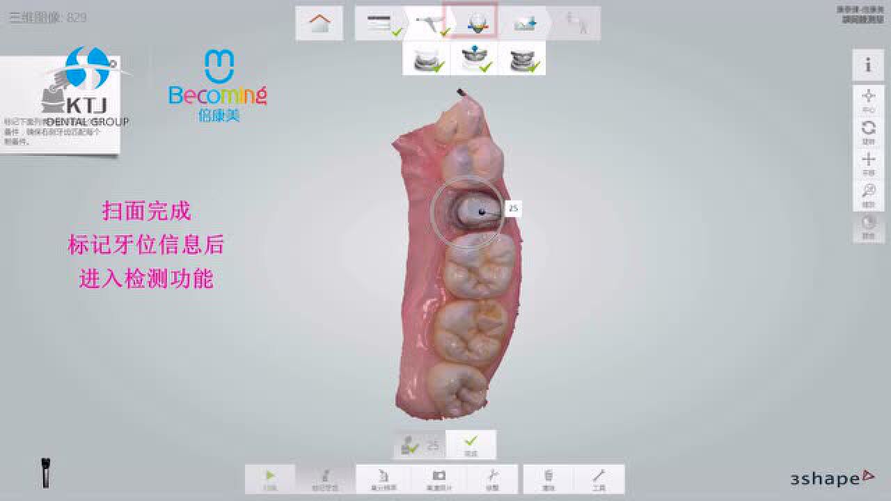 3shape口扫功能_高清1080P在线观看平台_腾讯视频