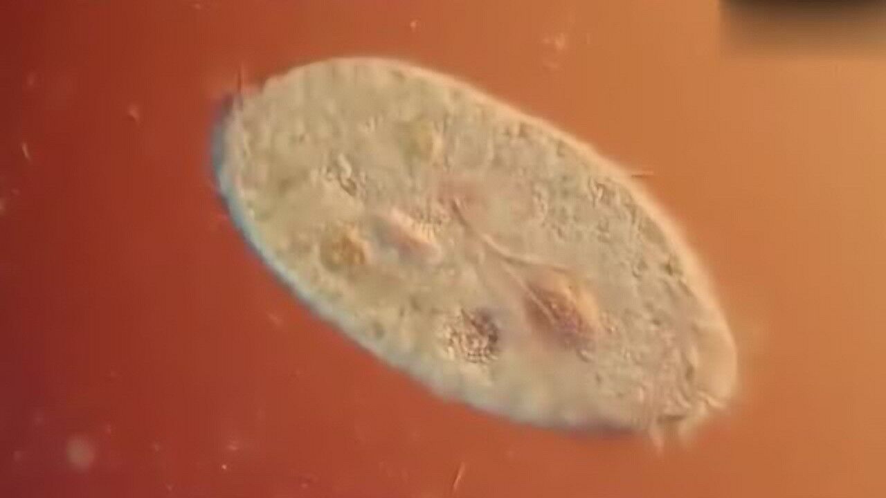 显微镜下一滴水里的微生物，看你还敢不敢喝生水！_腾讯视频