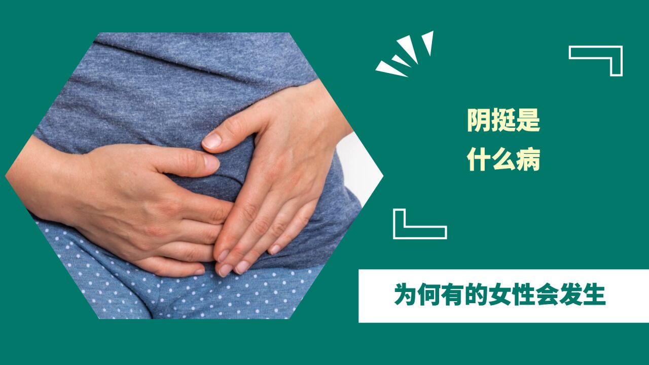 阴挺搜狗百科