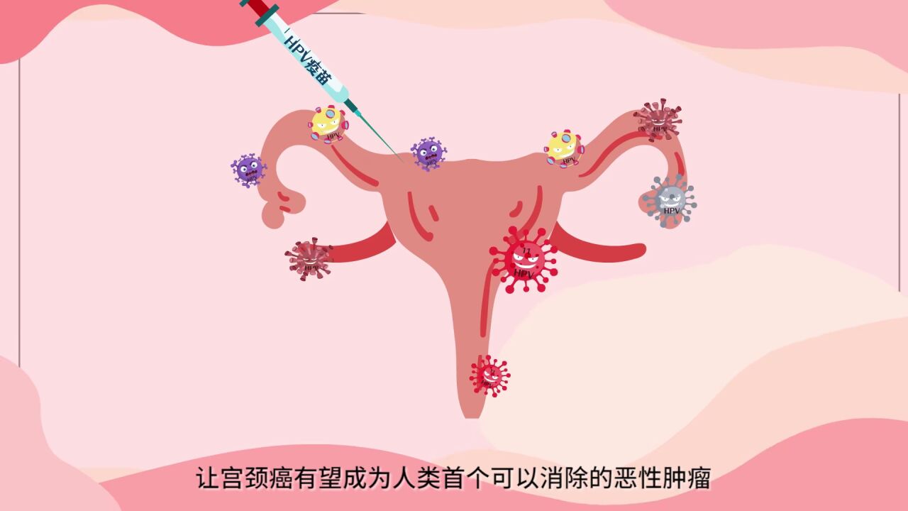 【国际HPV知晓日】HPV疫苗哪个年龄段接种最好？_高清1080P在线观看平台_腾讯视频