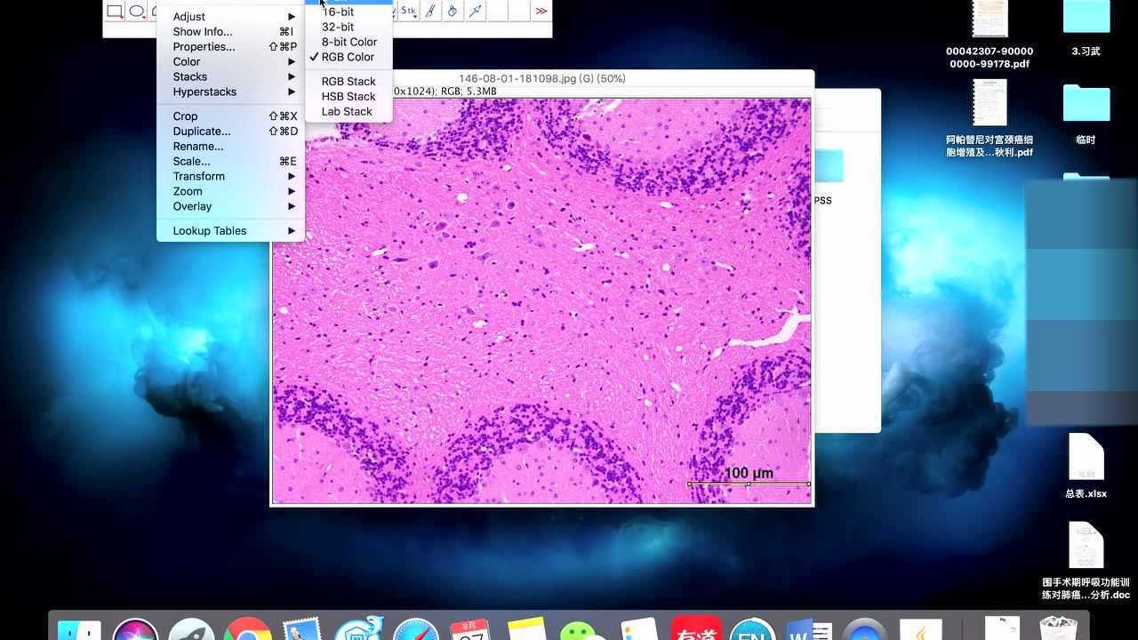 利用ImageJ软件进行特定区域面积计算_腾讯视频
