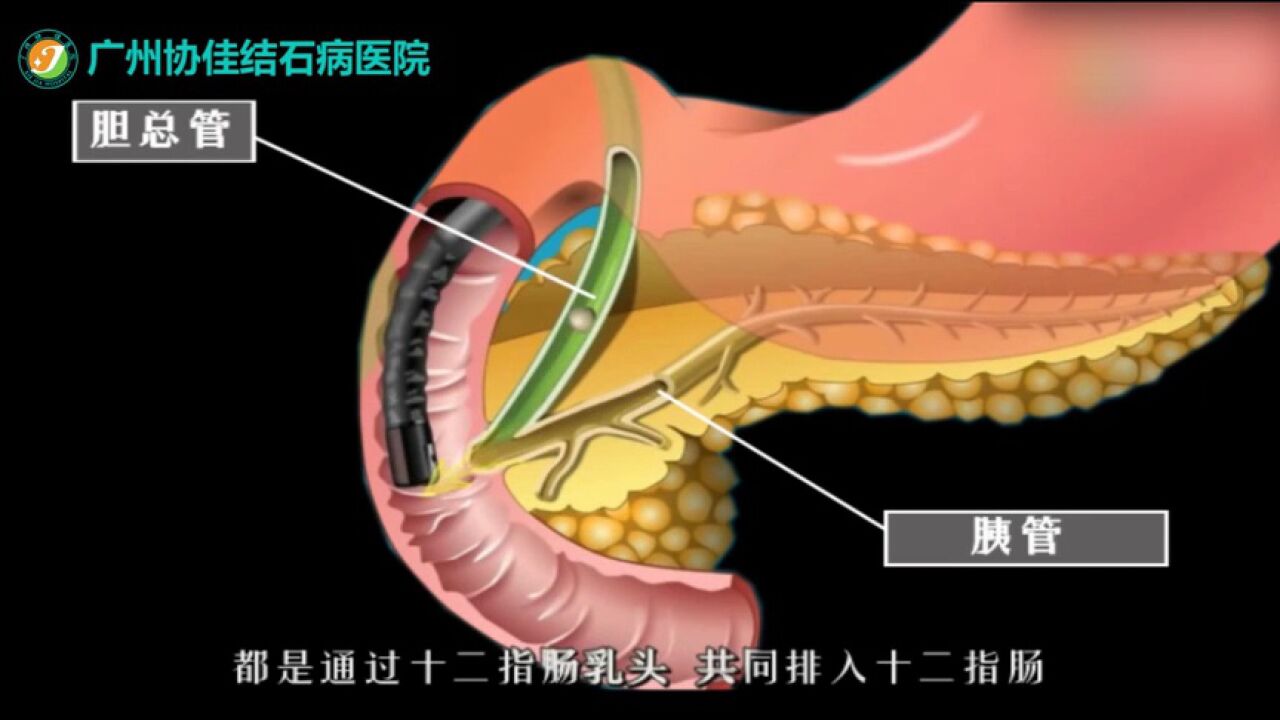 【PPT】内镜下胰胆管造影术（ERCP）的治疗与护理_高清1080P在线观看平台_腾讯视频