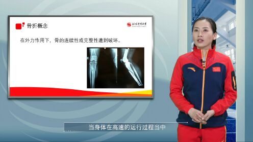 第17集运动损伤的急救处理：骨折（上）_第17集运动损伤的急救处理：骨折（上）_综艺_高清完整版视频在线观看_腾讯视频