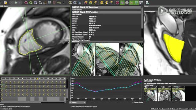 cvi42 5.1新版本的功能介绍_腾讯视频