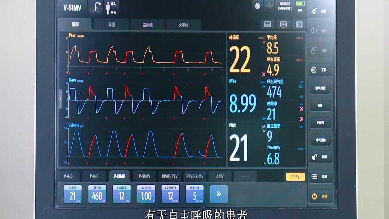 V-SIMV模式_高清1080P在线观看平台_腾讯视频