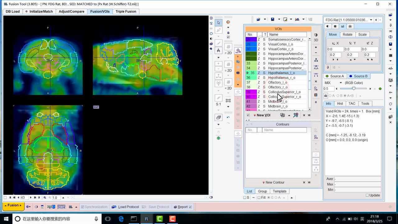 PMOD软件PFUS操作和应用_高清1080P在线观看平台_腾讯视频
