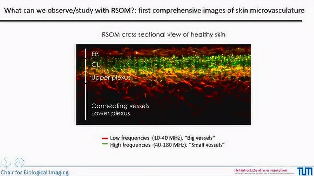 iTheraMedical光栅扫描光声介观显微镜（RSOM）在皮肤炎症成像中的应用_高清1080P在线观看平台_腾讯视频