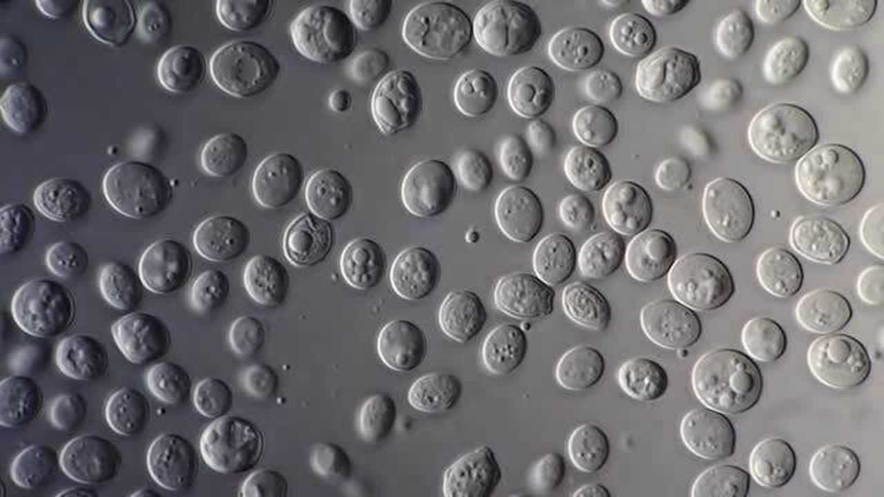 1000倍显微镜下的酵母_高清1080P在线观看平台_腾讯视频