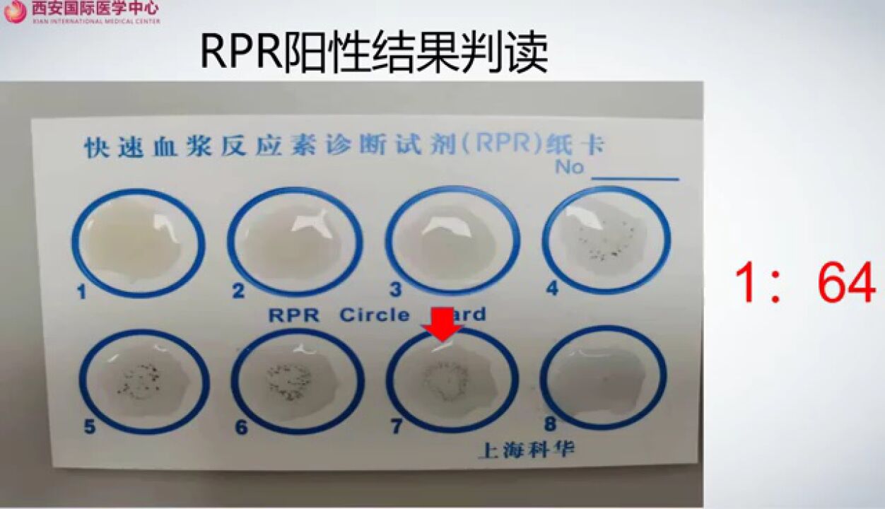 7.20李茹TPPA与RPR_高清1080P在线观看平台_腾讯视频