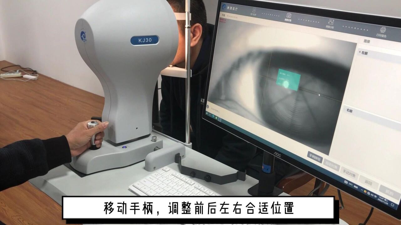 康捷医疗KJ30角膜地形图仪-操作视频_高清1080P在线观看平台_腾讯视频